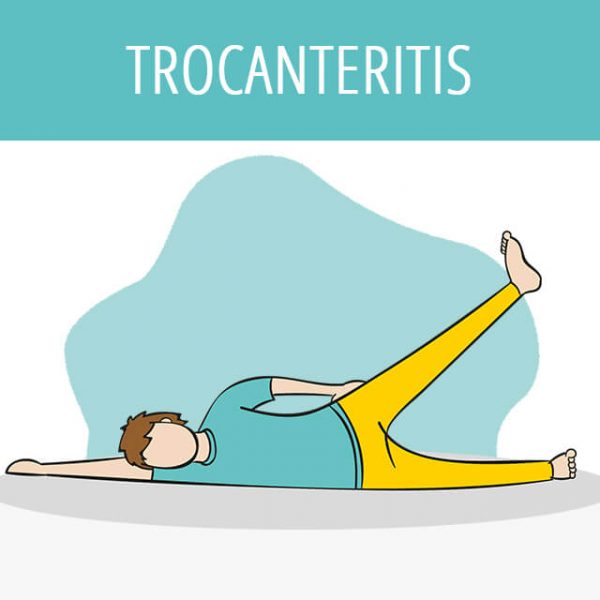 Trocanteritis | Centro de Fisioterapia Sane Pilates